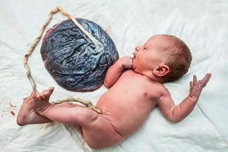 Lotosový porod: Porod bez přeříznutí pupku